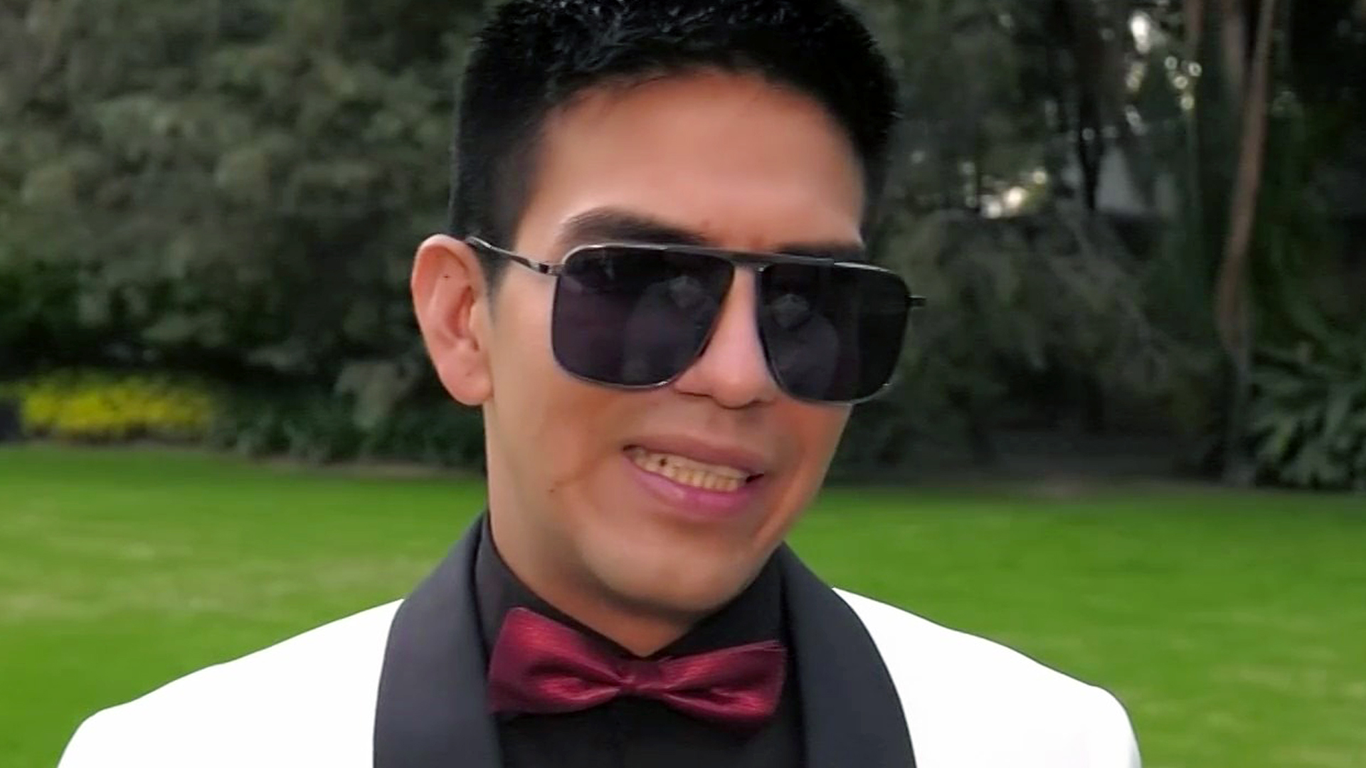 A dos años de su terrible accidente, Jovanny Cadena anuncia que será ...