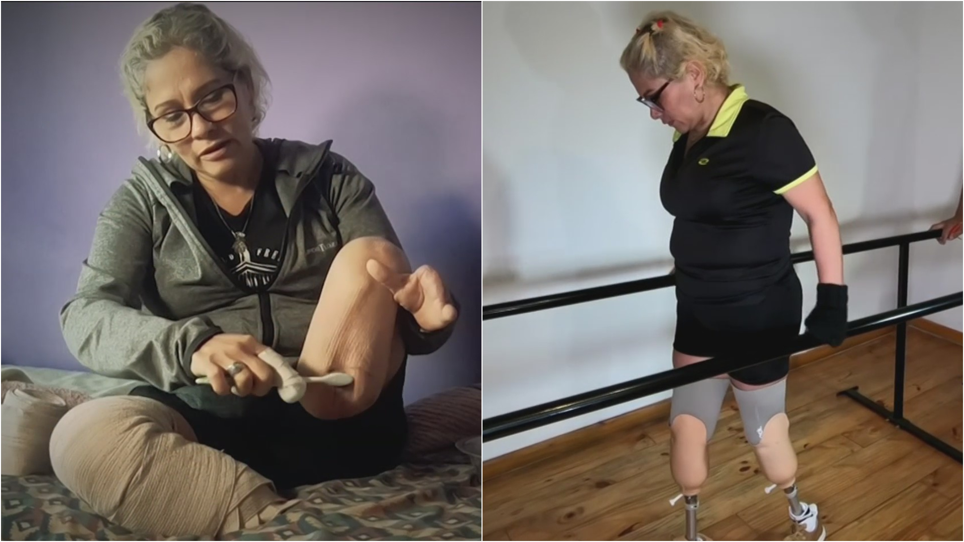 Le amputaron las piernas tras complicaciones por coronavirus: tras ...