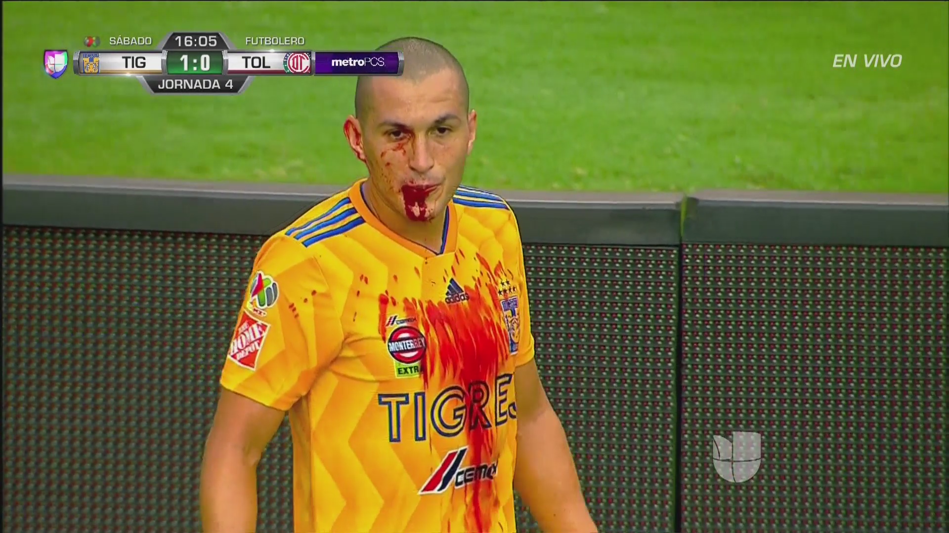 ¡Impactante! Torres Nilo recibió un codazo que le provocó seria herida ...