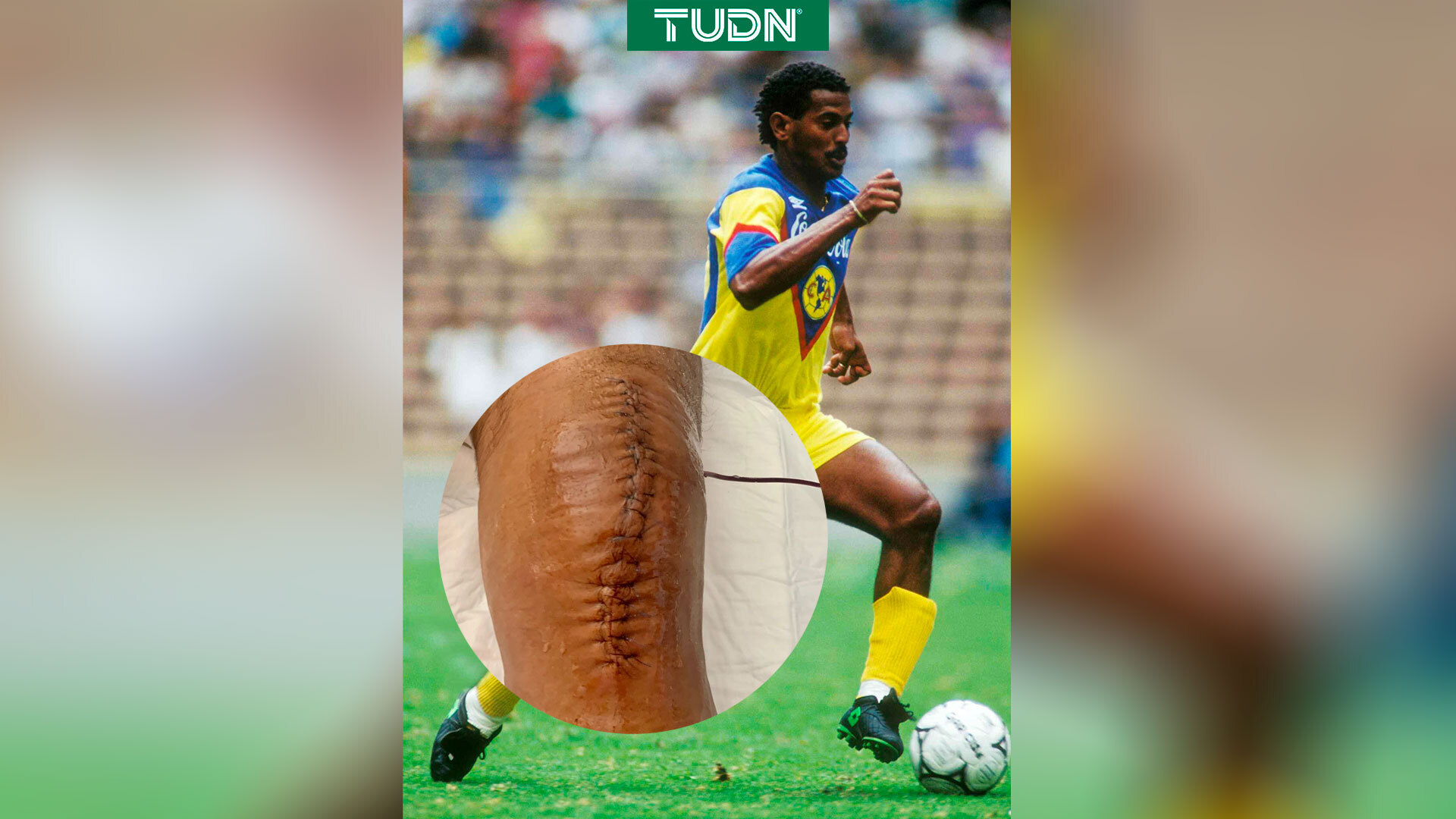 Fuertes imágenes: así quedaron las rodillas de exjugador de América ...