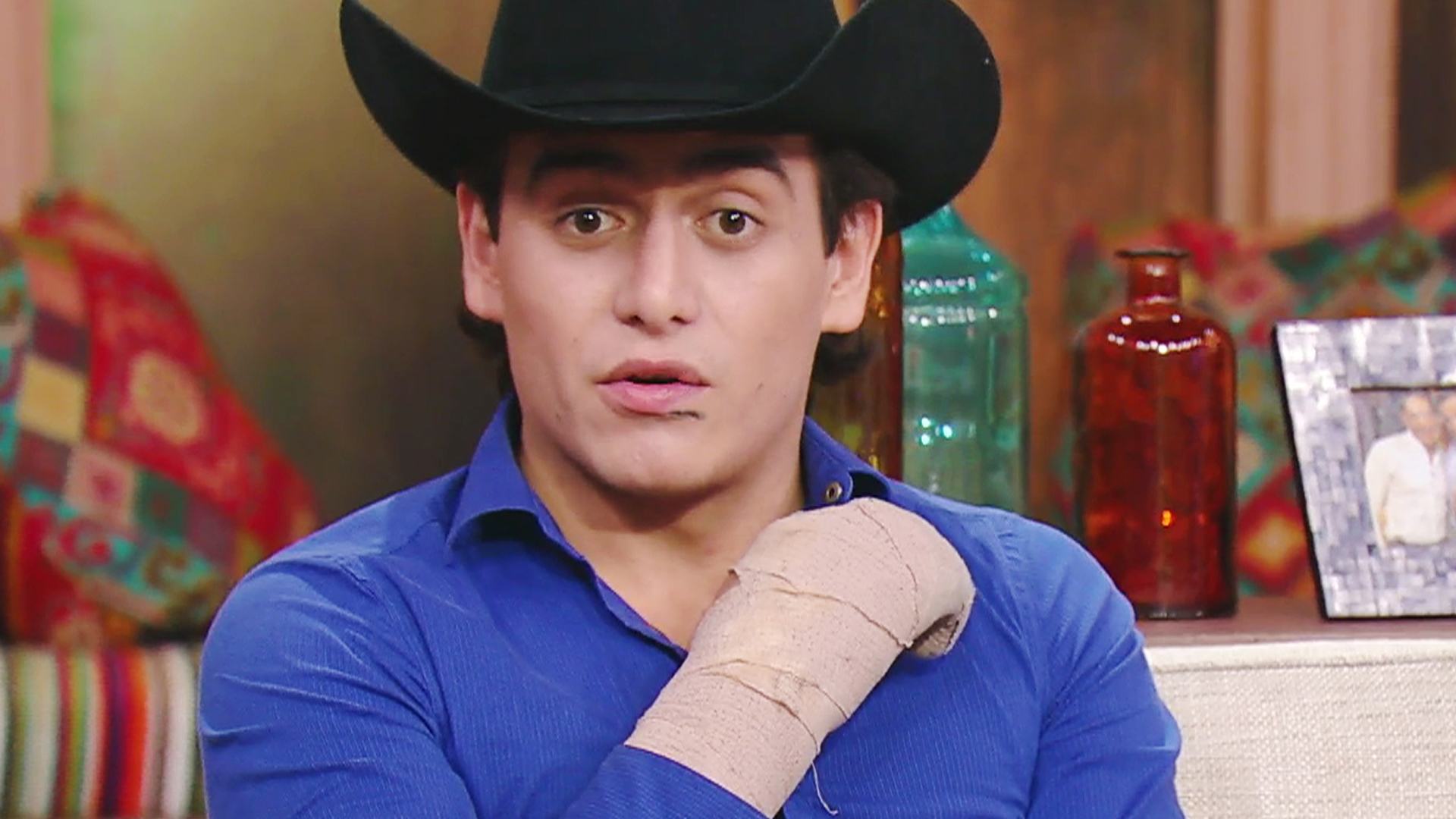 Fue una locura: ¿Por qué Julián trae una mano vendada y un labio roto ...