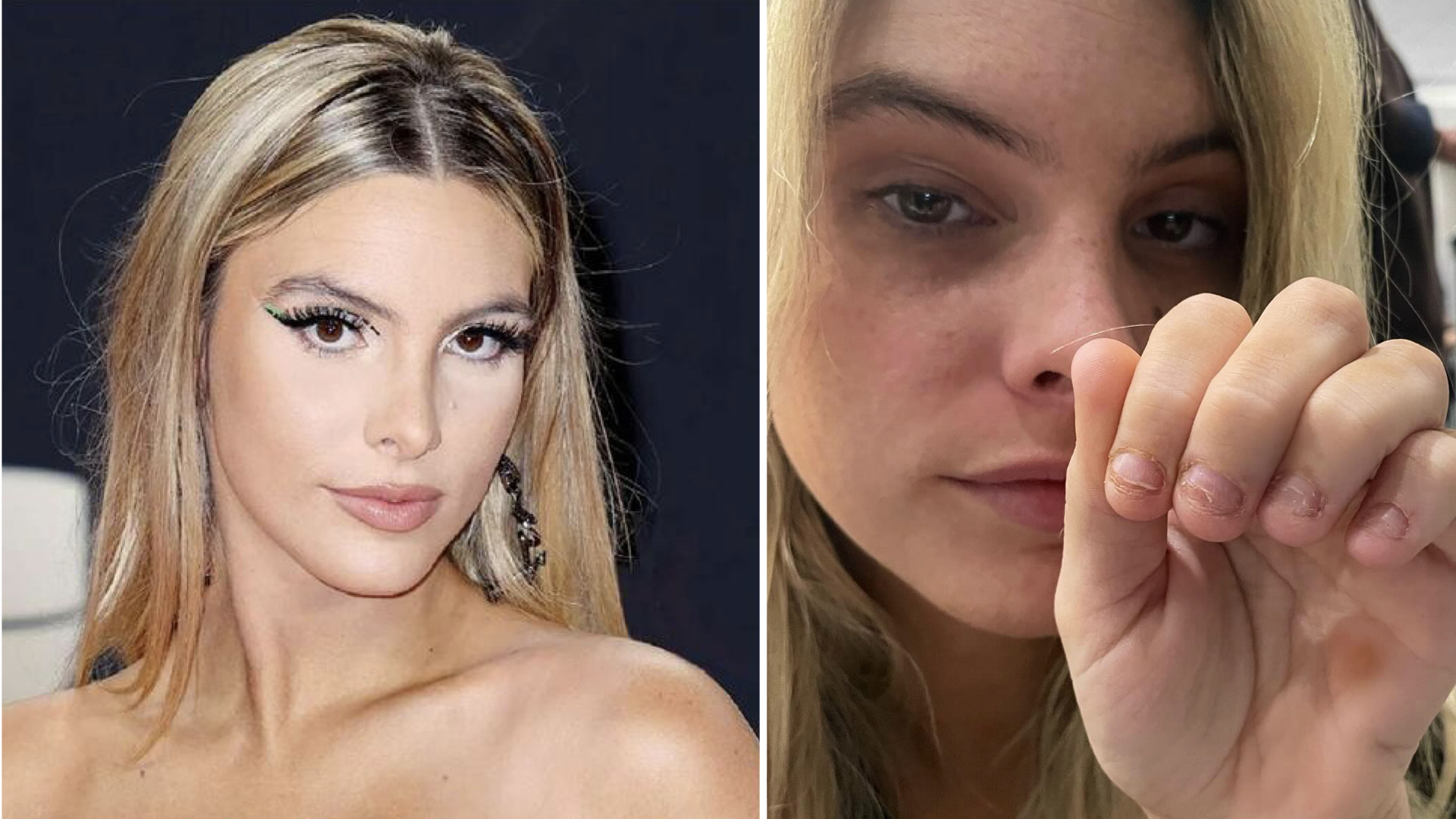 Lele Pons lucha contra trastorno obsesivo compulsivo y deja un mal ...