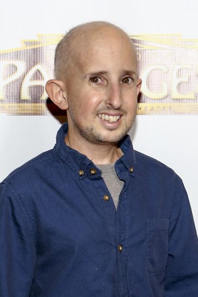 Muere Ben Woolf de golpe en la cabeza | Univision Famosos | Univision