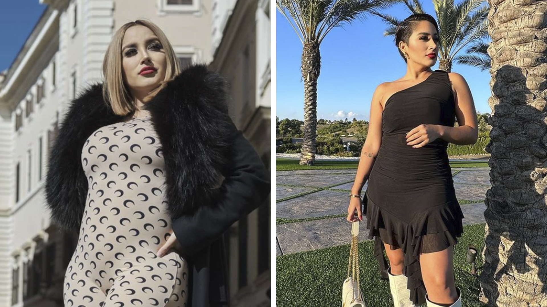 Daisy Anahy revela las cirugías estéticas que se hizo tras el ...