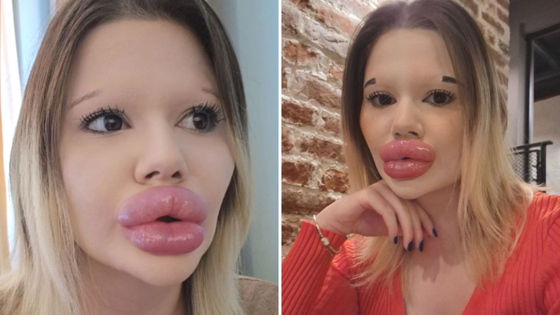 Andrea Ivanova es la mujer con "los labios más grandes del mundo": esto ...