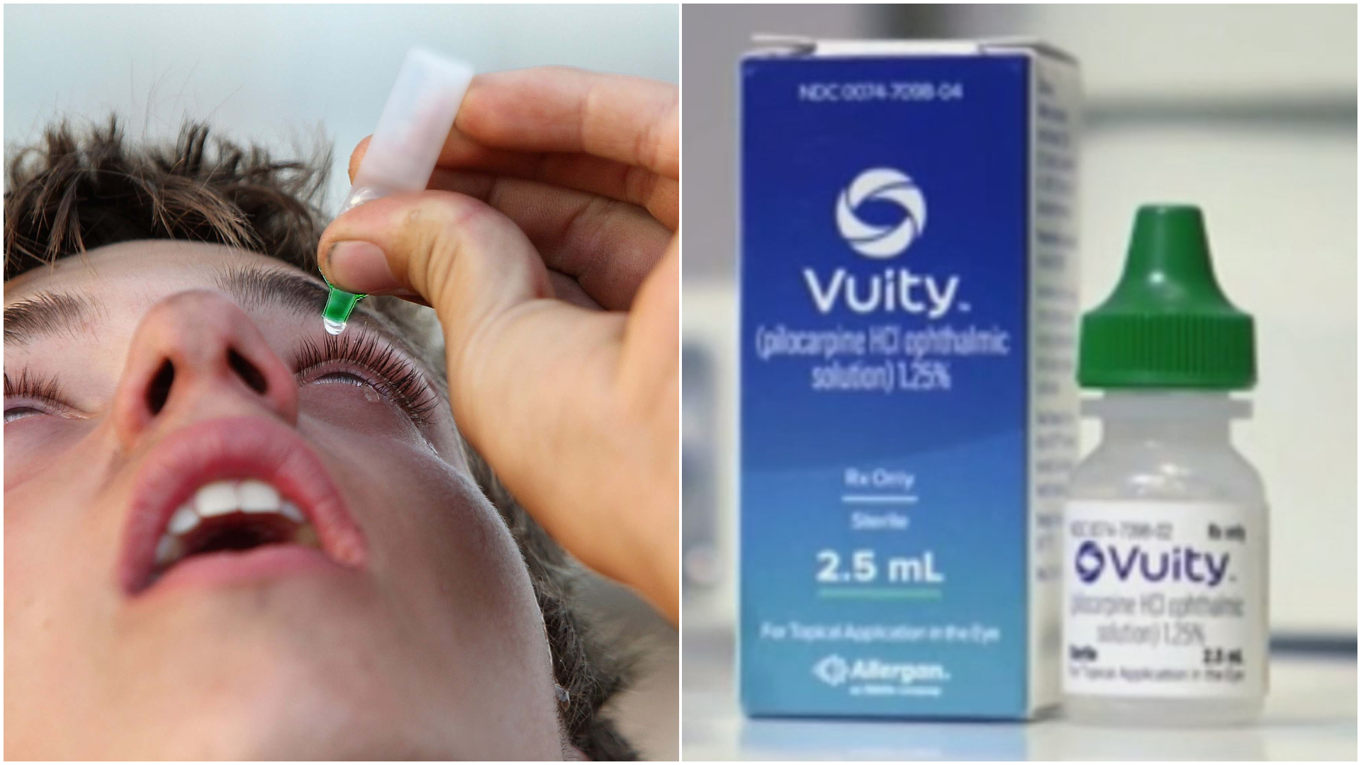 La FDA aprueba las gotas Vuity, las cuales ayudan a personas con ...