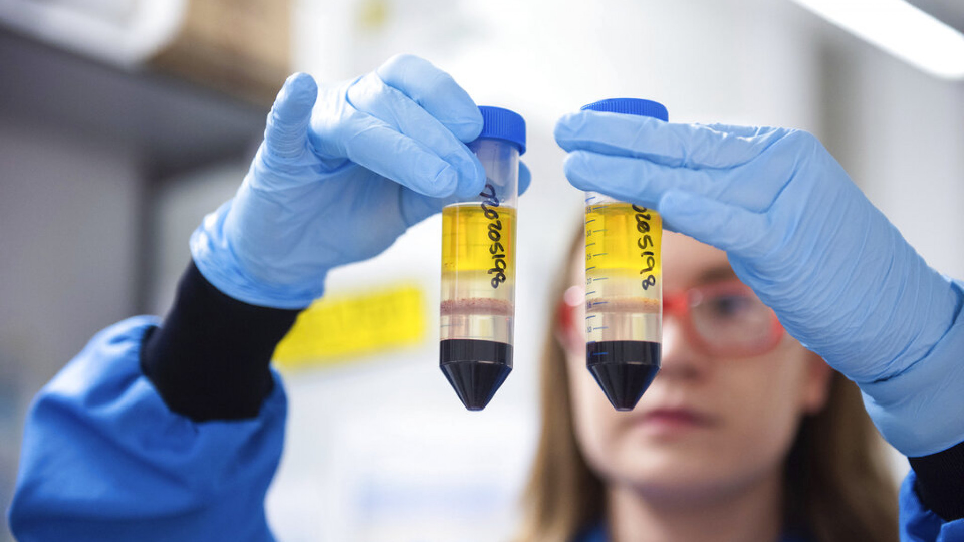 El laboratorio AstraZeneca anunció que su vacuna es casi 90% efectiva ...