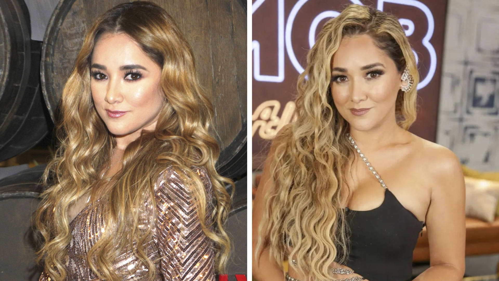 Sherlyn habla de la única cirugía que se ha hecho y le cambió su vida: ''La abrazo con amor ...