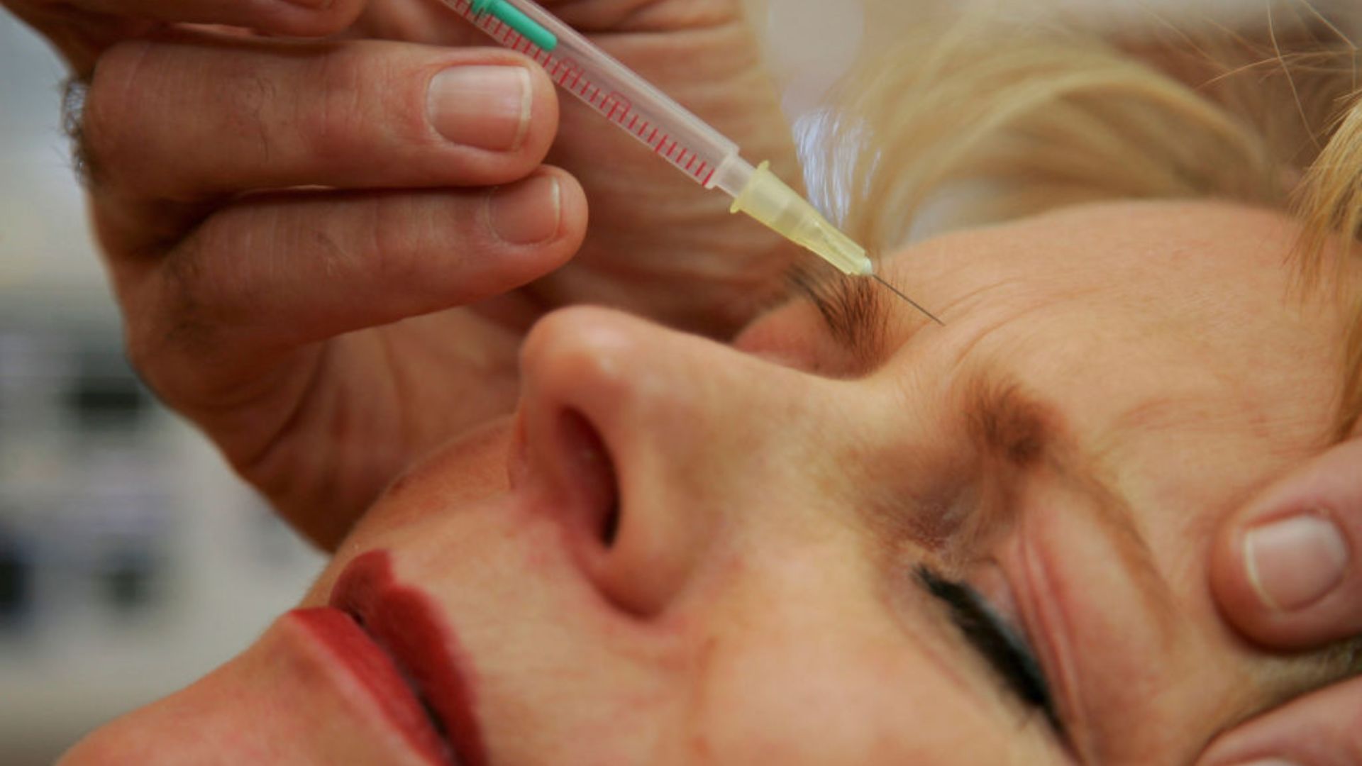 Procedimientos con bótox falso encienden las alertas en Estados Unidos ...