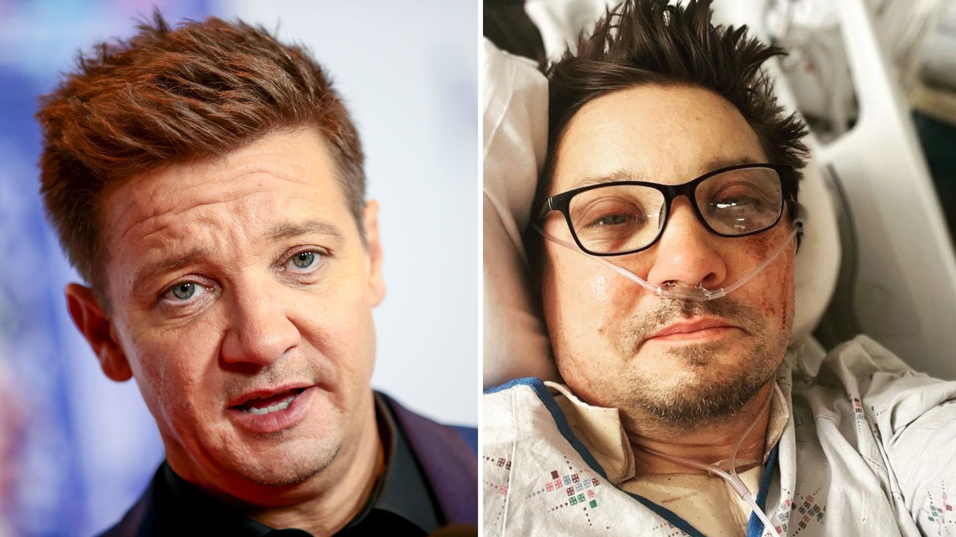 Jeremy Renner: llamada al 911 es revelada y deja al descubierto ...