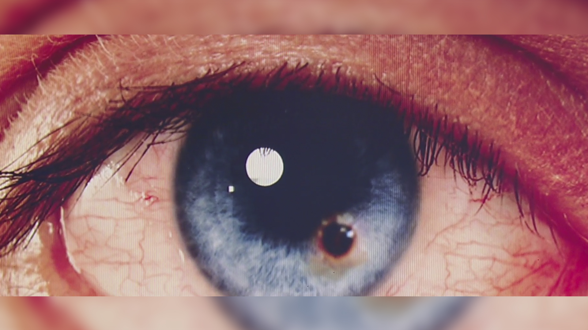 Atención a estas señales que pueden indicar que hay una hemorragia en ...