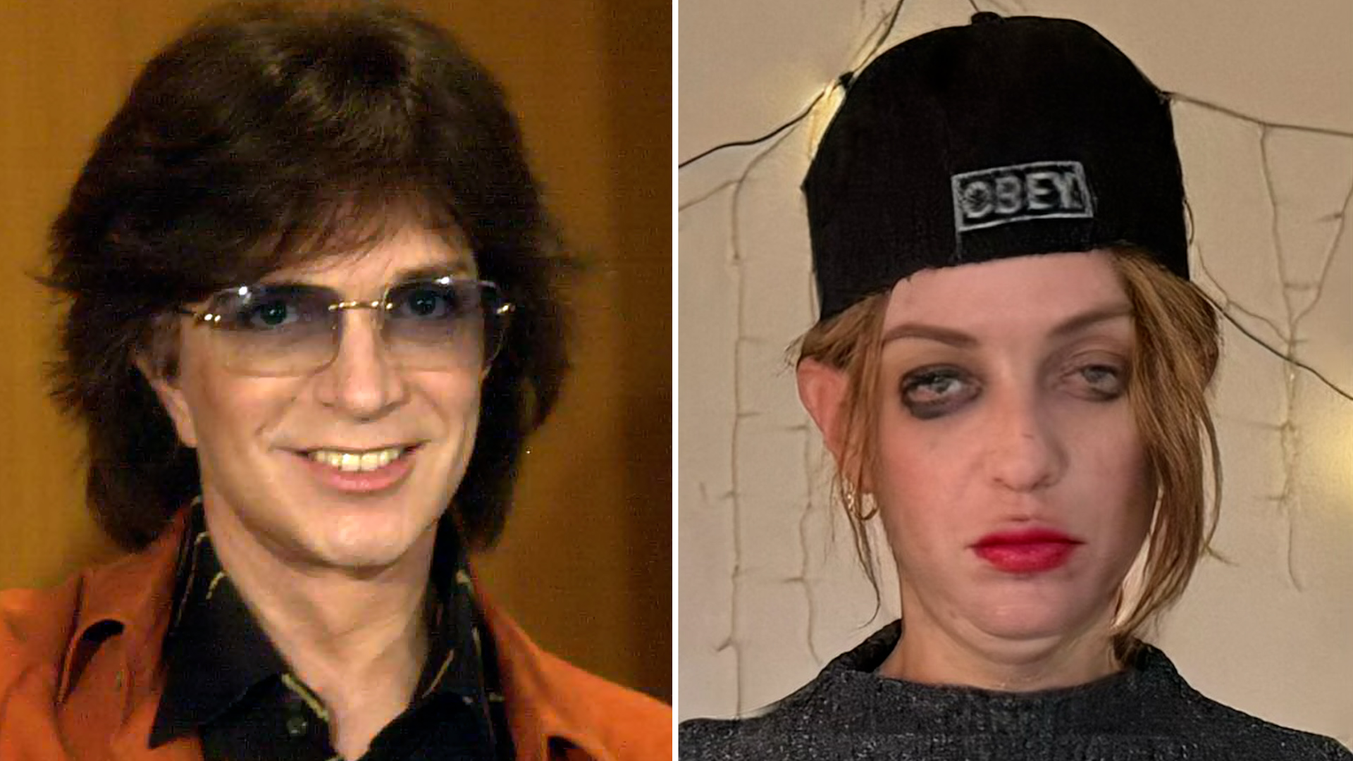 Hijo de Camilo Sesto muestra su transformación: alerta por heridas en su cuerpo | Univision ...