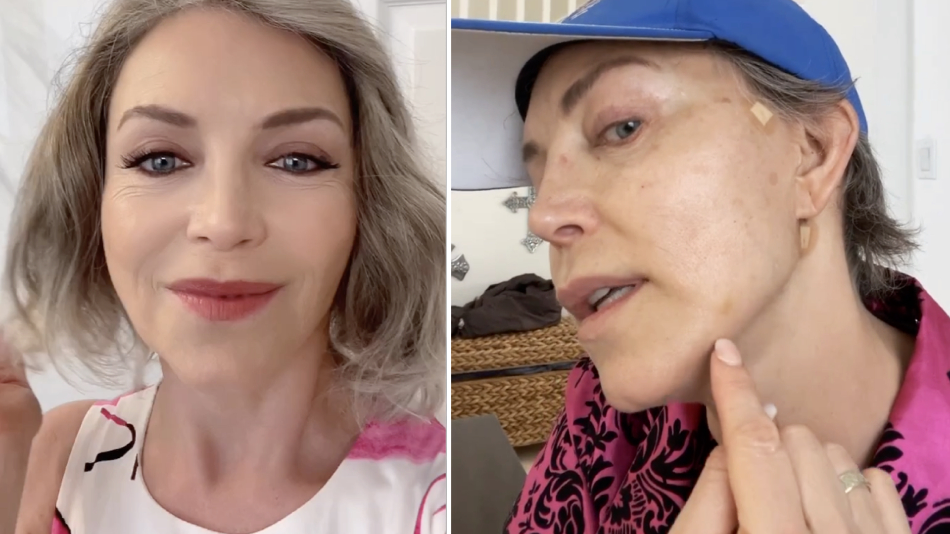 Laura Flores somete su rostro a hilos tensores a sus 59 años y muestra ...