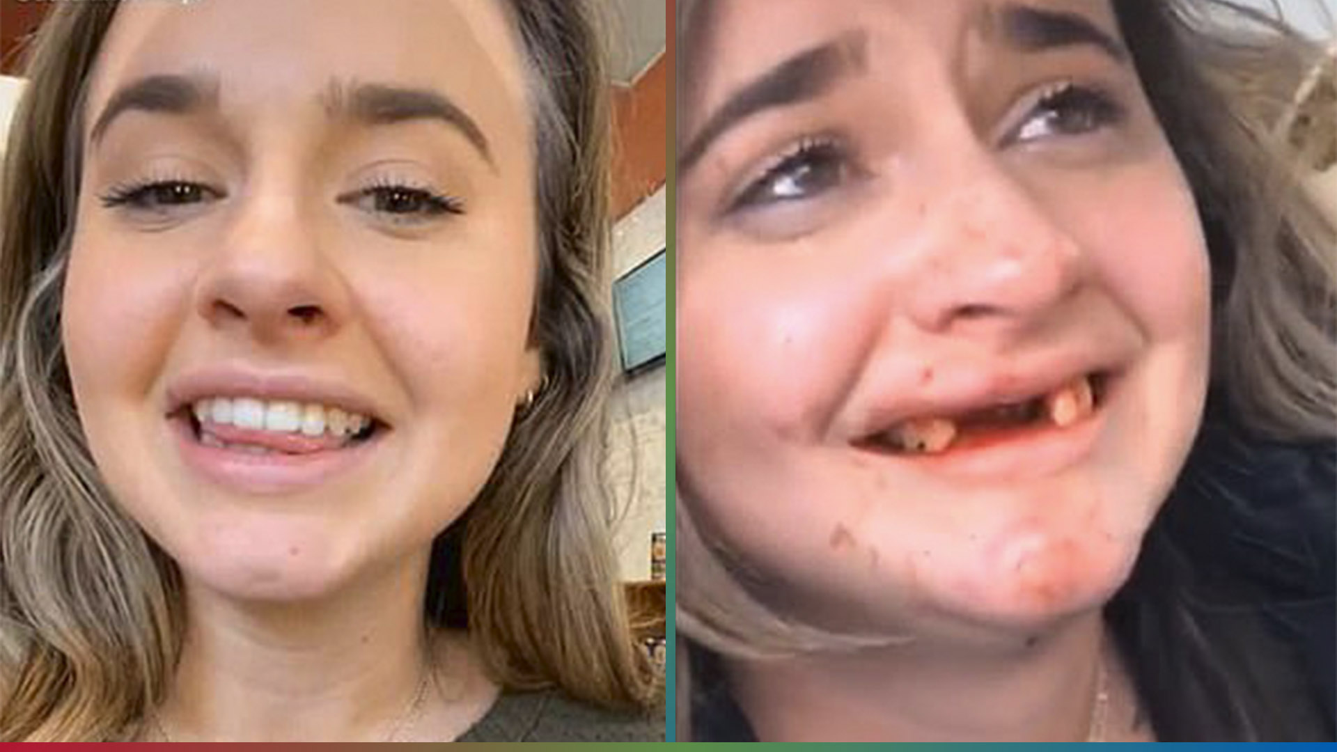 TikToker queda 'chimuela' tras hacer video mientras tomaba unas ...