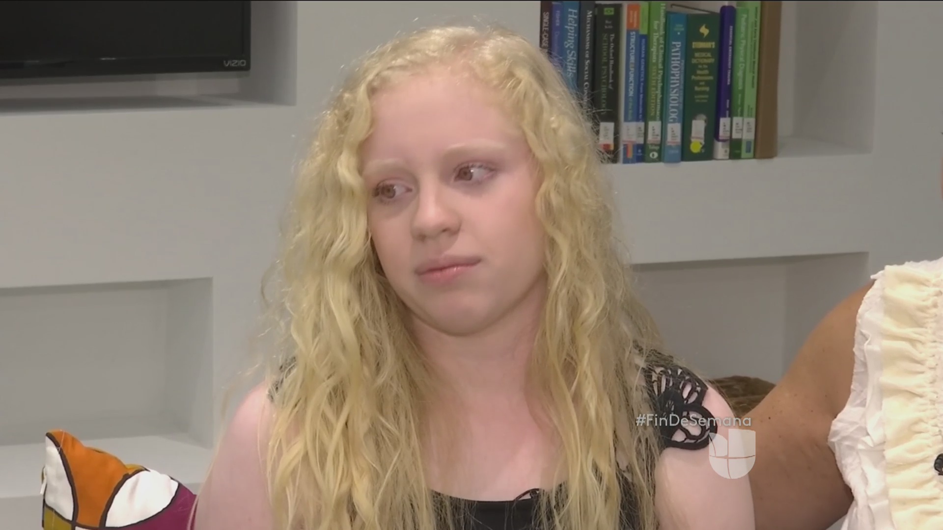 El albinismo y sus obstáculos en Puerto Rico | Shows Noticiero ...