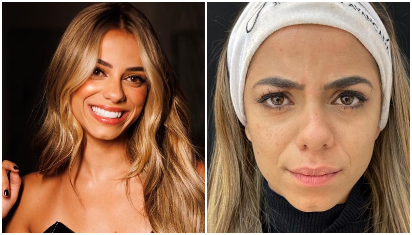 Antes e depois de Key Alves: ex-BBB faz harmonização e mostra resultado ...