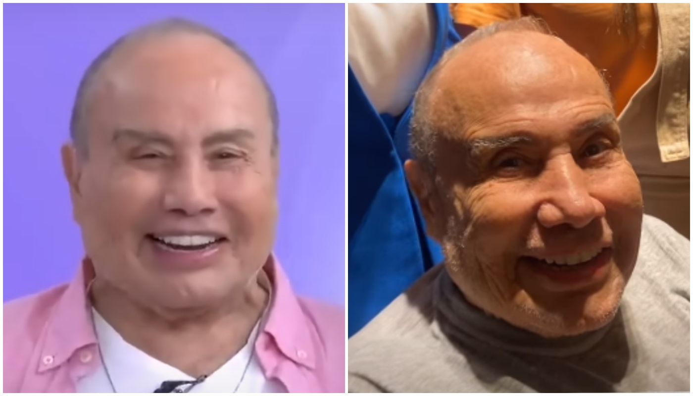 Harmonização facial de Stenio Garcia: ator volta a aparecer após ...