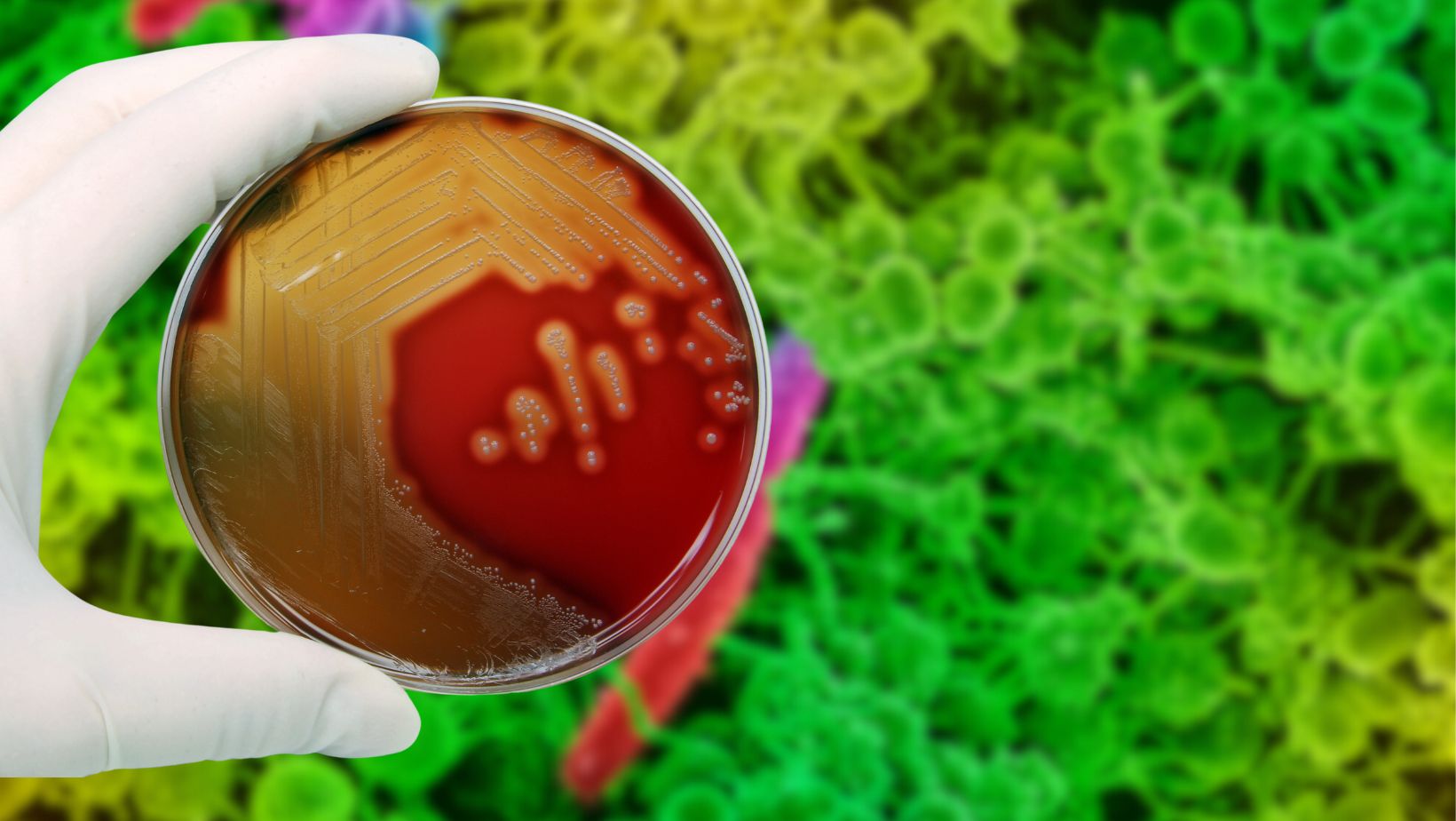 Las señales de alerta de una infección grave por estreptococos en niños ...